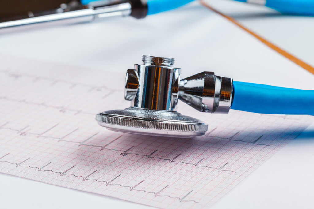 12 Lead ECG vs Single Lead ECG - Tricog Health